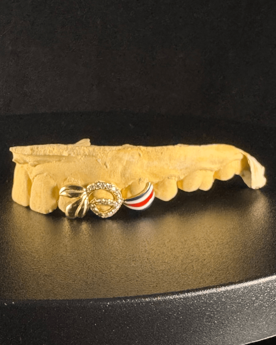 How Diamond Grillz Became the Ultimate Symbol of Hip-Hop
